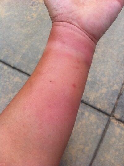 GARNER FAMILY PRACTICE - Garner NC - Hours, Directions, Reviews ...